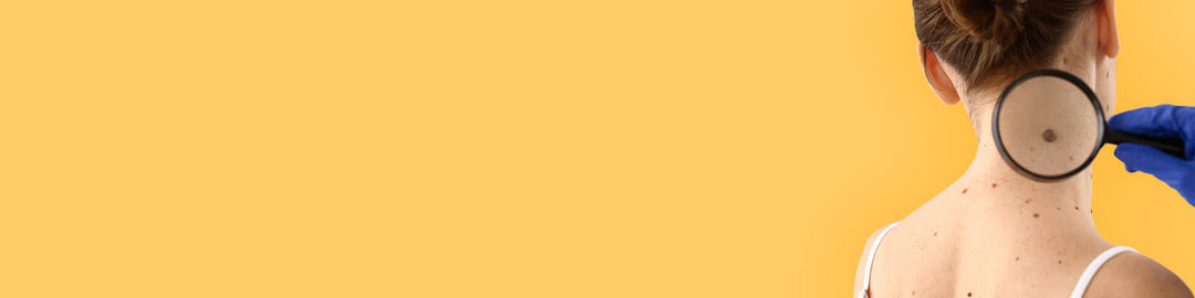 Lumps & Bumps (Skin Lesions) Removal – Laser & Lipstick Skin and Laser Clinic