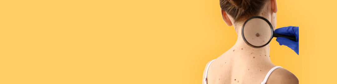 Lumps & Bumps (Skin Lesions) Removal – Laser & Lipstick Skin and Laser Clinic